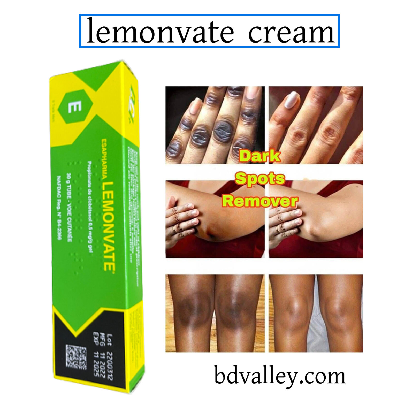 Lemonvate Cream Removing Dark Spot – Bd Valley Online Shop
